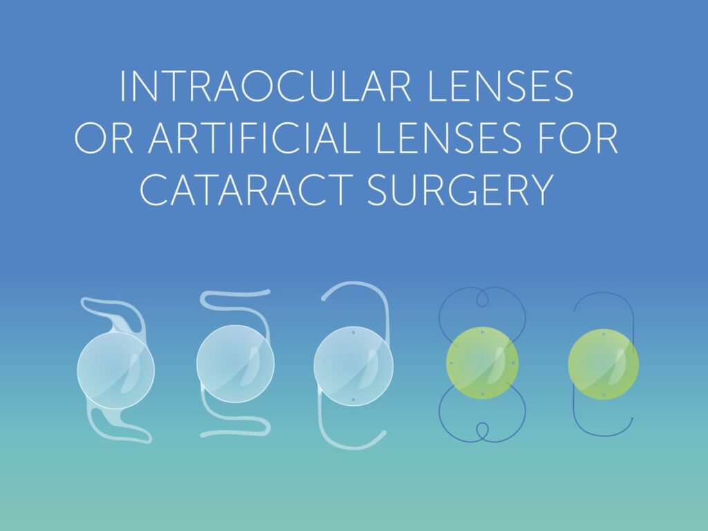 Types of Intraocular Lenses (IOLs) for Cataract Surgery